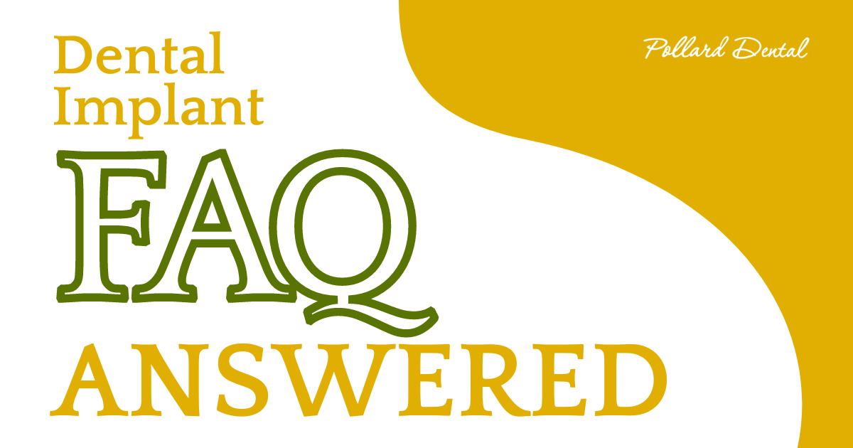 Frequently Asked Dental Implant Questions Answered - Pollard Dental Frequently Asked Dental Implant Questions Answered - Pollard Dental